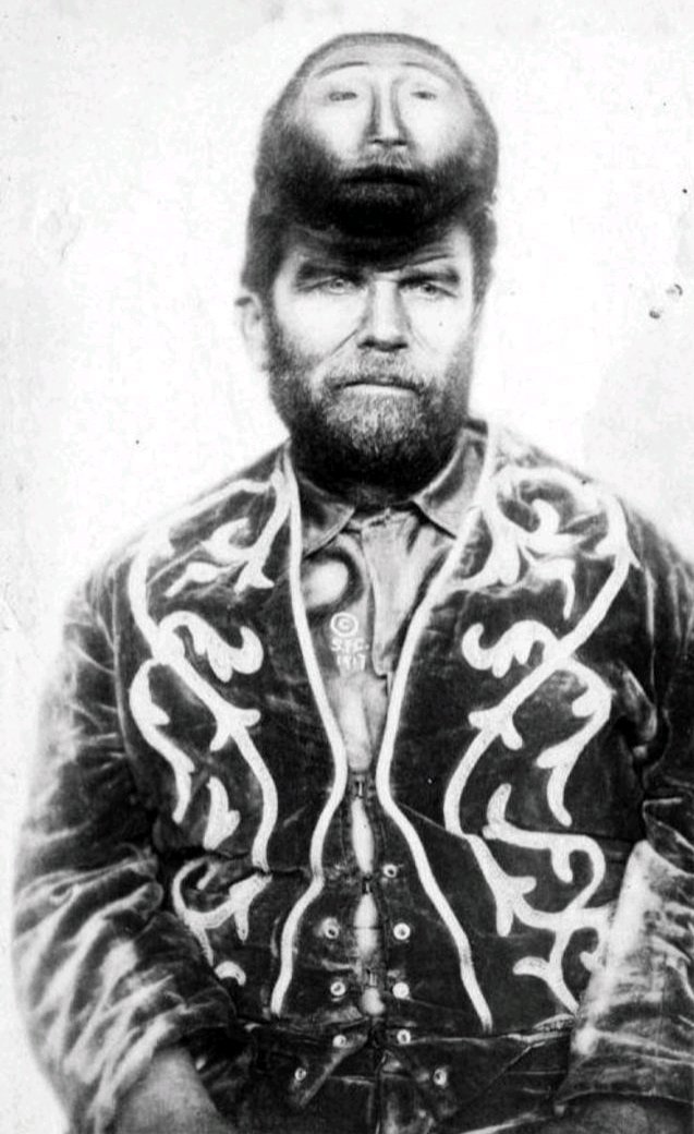 The Captivating Story of Mexican Man Born With Two Heads - Pascual ...